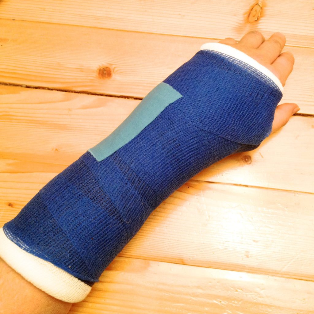 Armbruch ist (k)ein Handicap – fadenspiel und fingerwerk