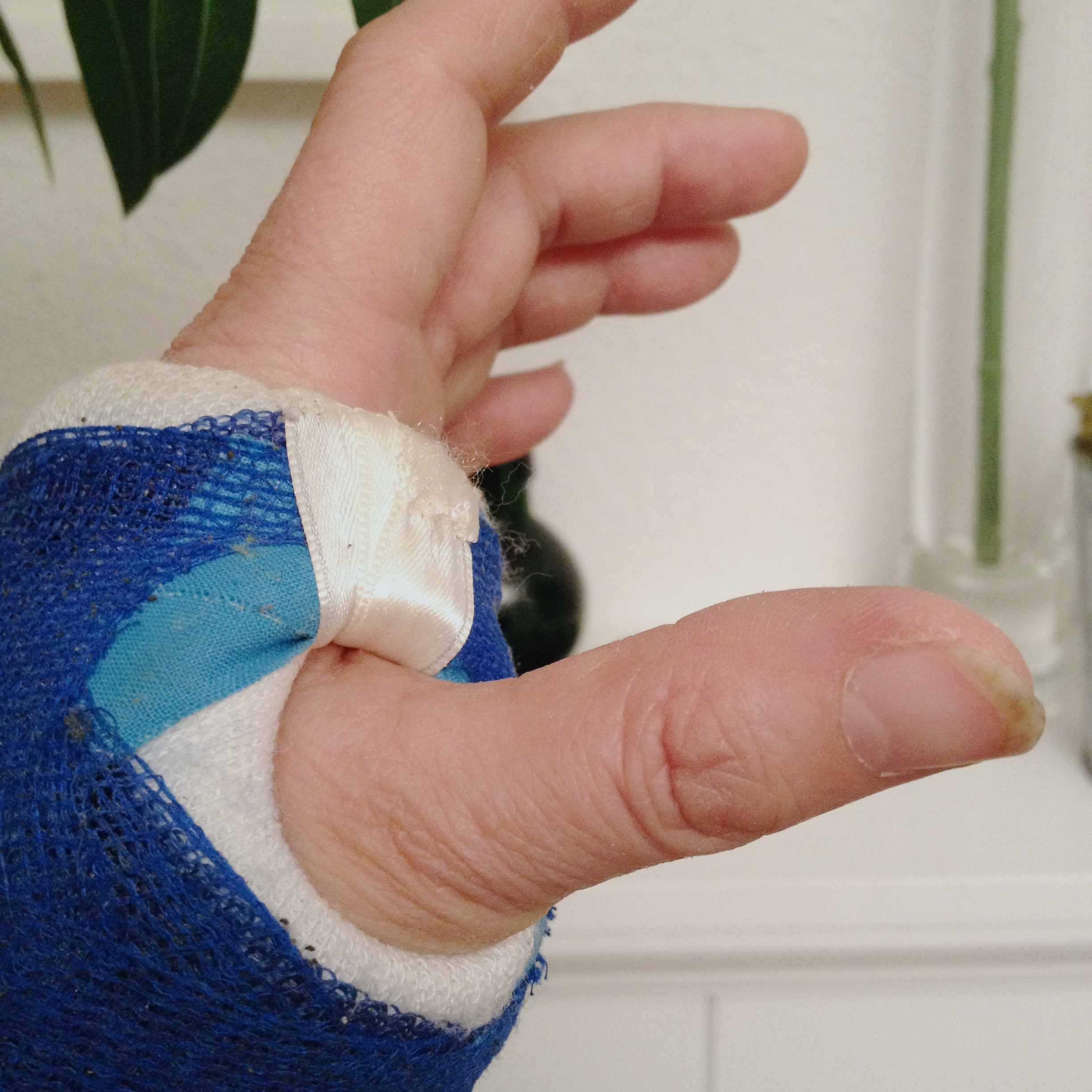 Herr Doktor, der Gips drückt – fadenspiel und fingerwerk